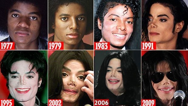 Michael Jackson'ın plastik cerrahı itiraf etti - KARAR
